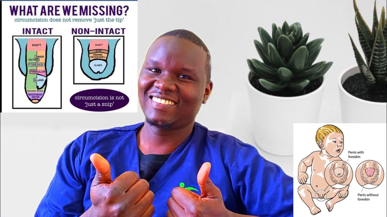 Circumcision & Big Facts| Shang Ring|Surgical|Benefits|Complications ...