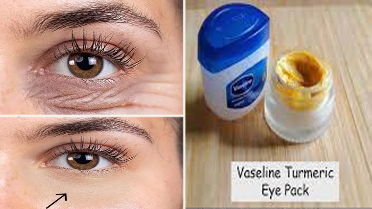 She Removed Dark Circles & Eye Wrinkles In 7 Days \\ Vaseline Turmeric ...