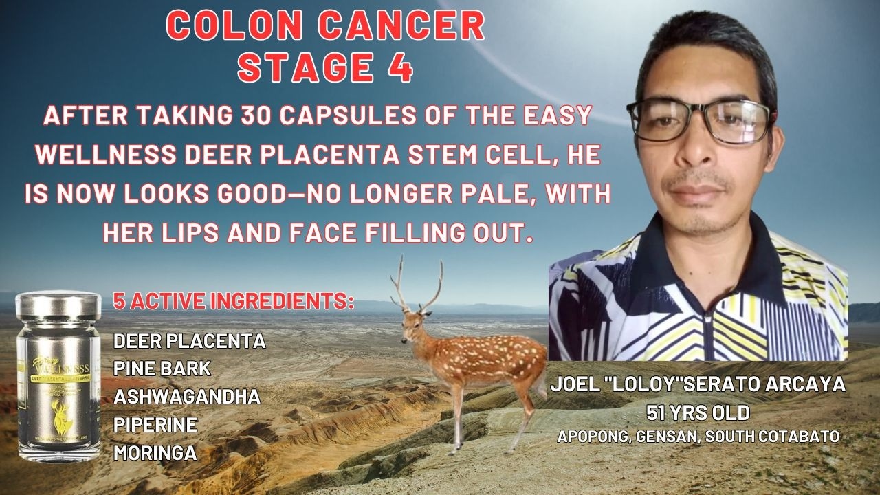 Deer Placenta Stem Cells helps Rheumatoid Arthritis, Colon Cancer ...