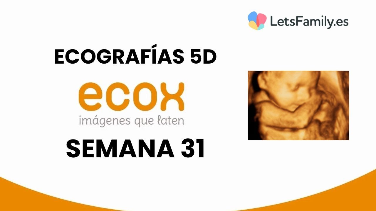 Ecografía 5D: semana 31 de embarazo - YouTube