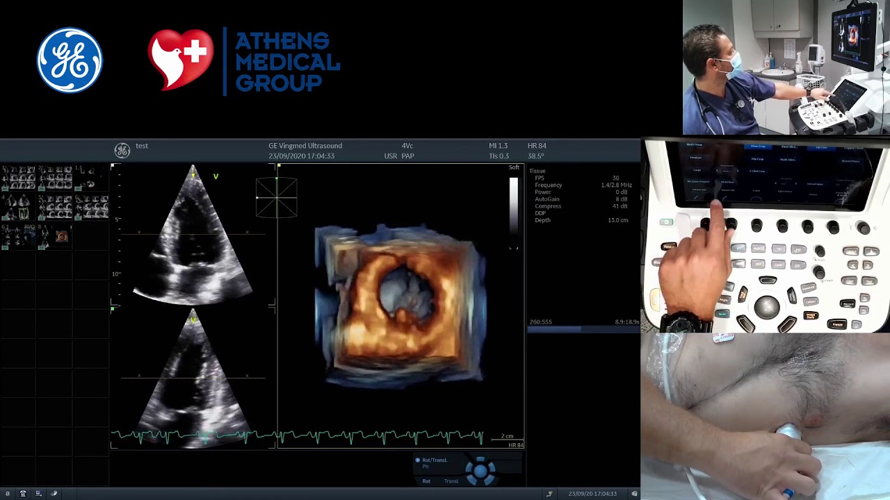 4D tutorials: 5. How to acquire 4D mitral valve views - YouTube