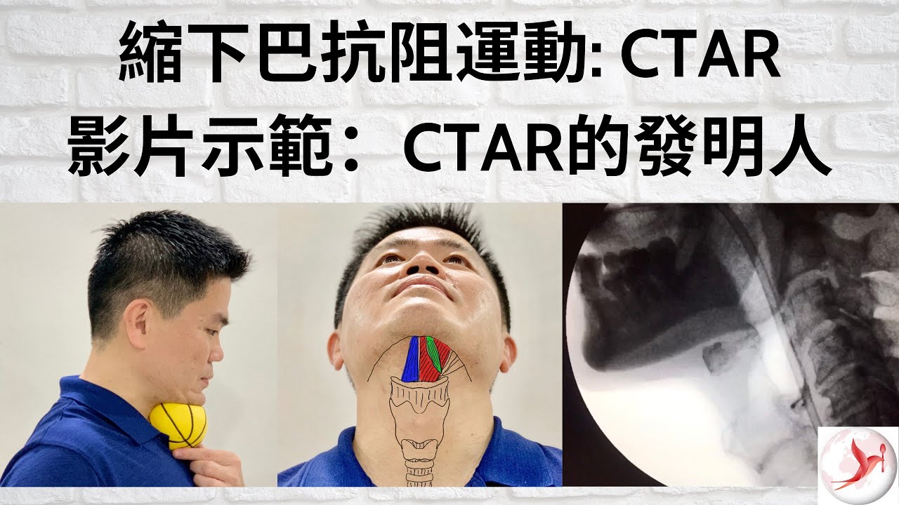 (Taiwanese Minnan) Dysphagia Exercise - Chin Tuck Against Resistance ...