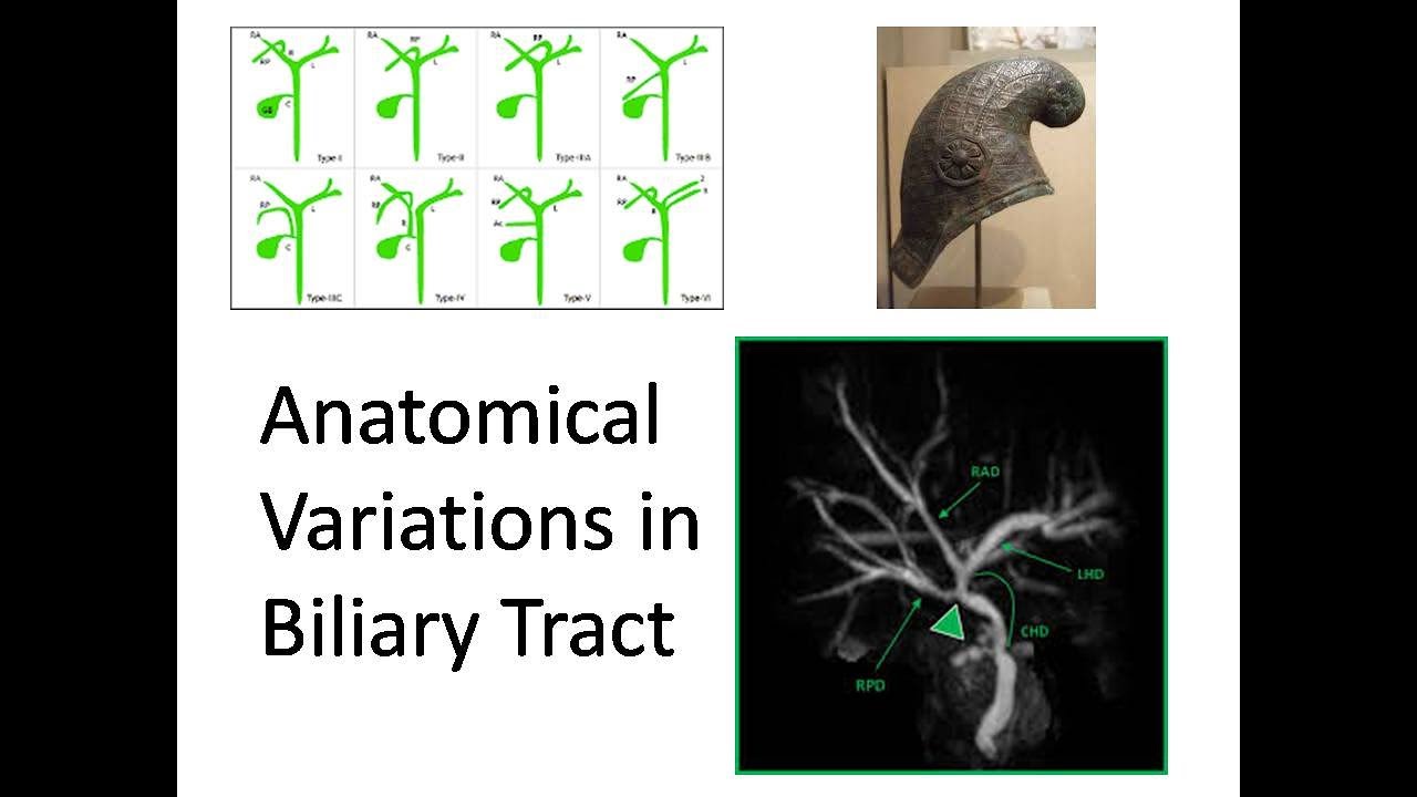 ANATOMICAL VARIATIONS IN BILIARY TRACT - YouTube