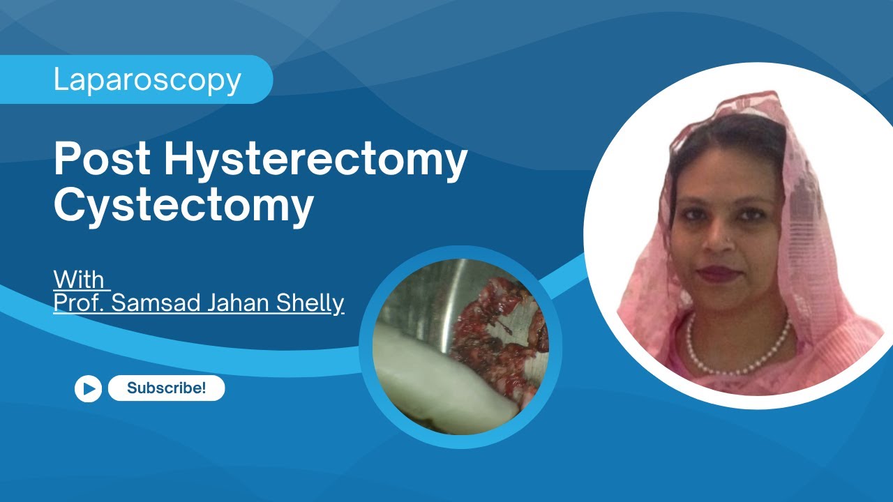 Post Hysterectomy Cystectomy - YouTube
