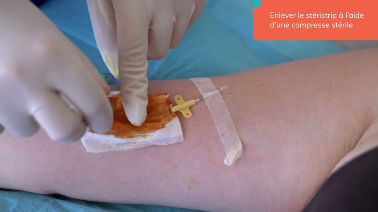 Réfection de pansement PICC ou MIDLINE - YouTube Réfection de pansement PICC ou MIDLINE - YouTube