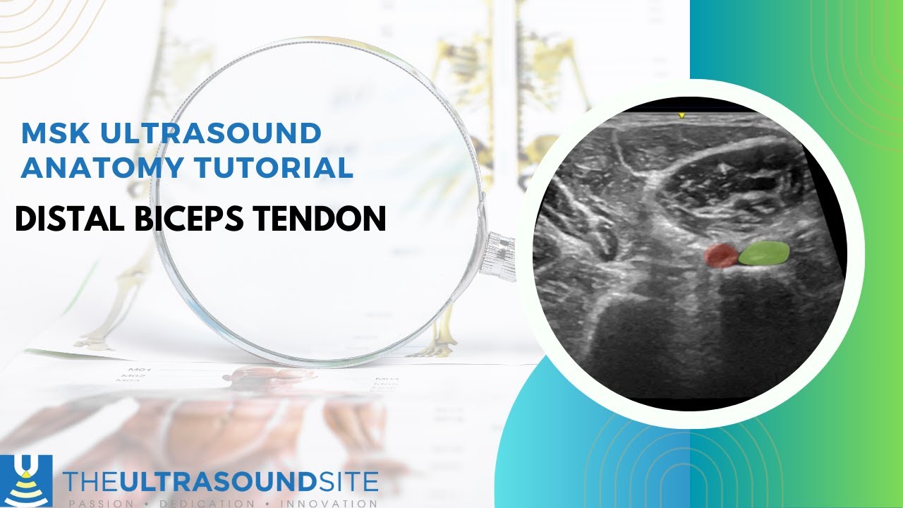 Anatomy tutorial of the distal biceps tendon and relevance to ...