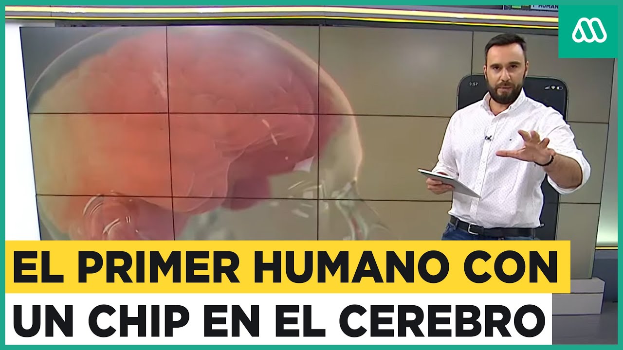 Primer humano con chip en el cerebro: Empresa de Elon Musk desarrolla ...