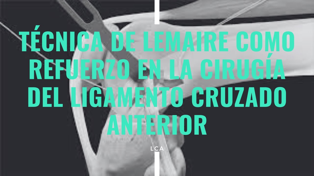 Técnica de Lemaire como refuerzo en la cirugía del ligamento cruzado ...