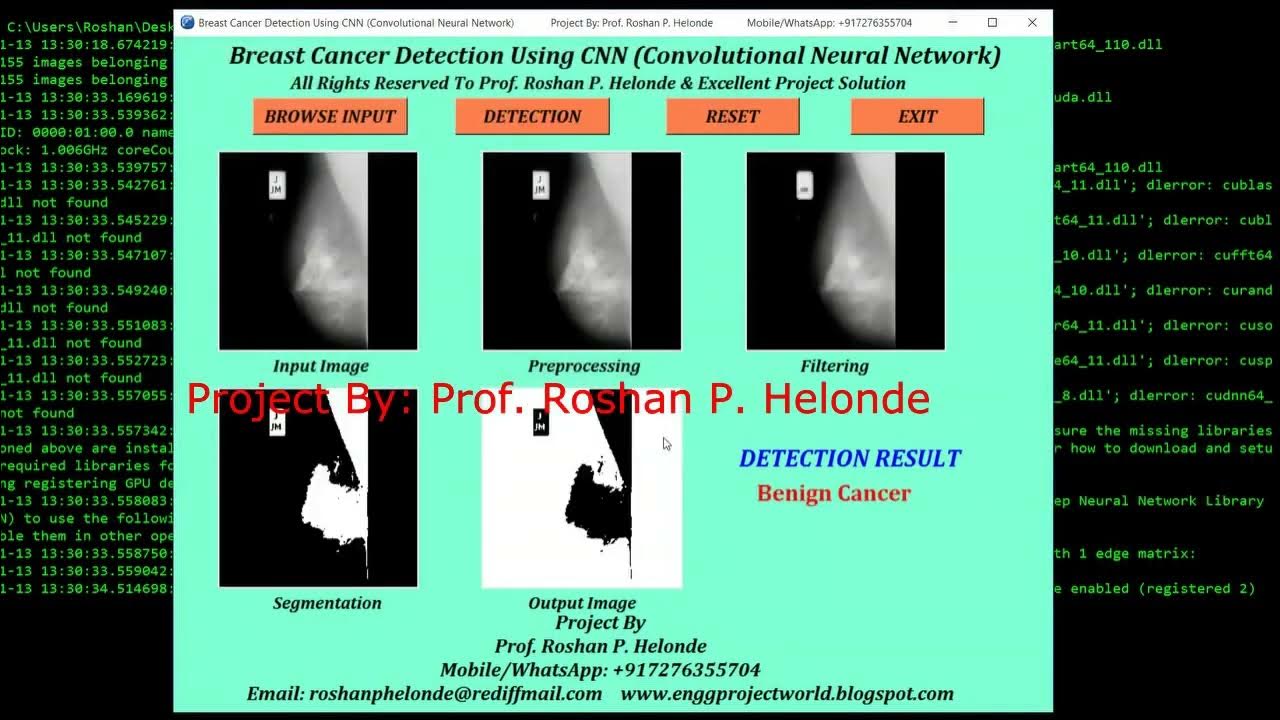 Breast Cancer Identification Using Image Processing Python Project With ...