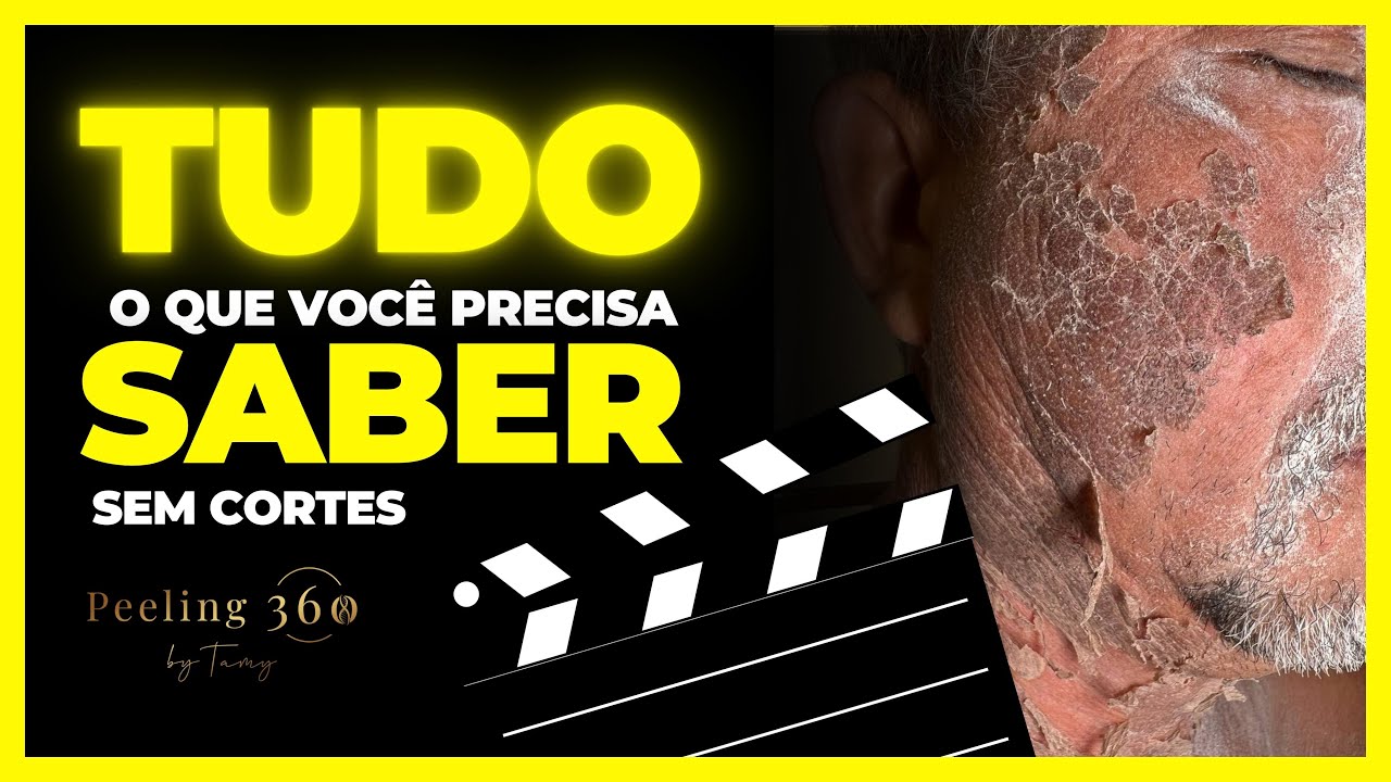 Peeling de algas | peeling 360 Aplicação com jato de plasma Monnaskin ...