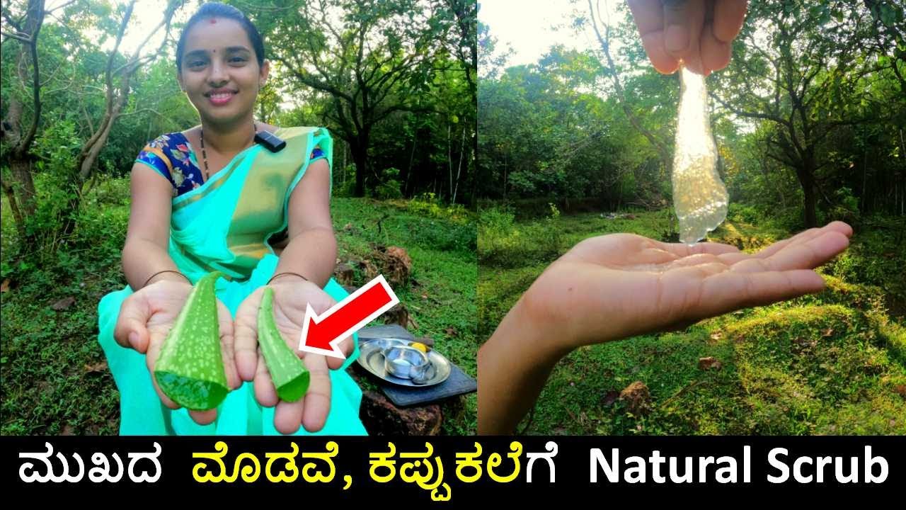 ಮೊಡವೆ ಕಪ್ಪುಕಲೆಗಳಿಗೆ ನೈಸರ್ಗಿಕ ಪರಿಣಾಮಕಾರಿ ಮನೆಮದ್ದು | aloe vera gel ...