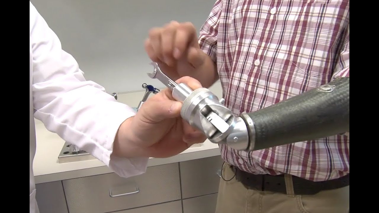 Moving Forward - From an Amputation to Creating a Unique Four-Way ...