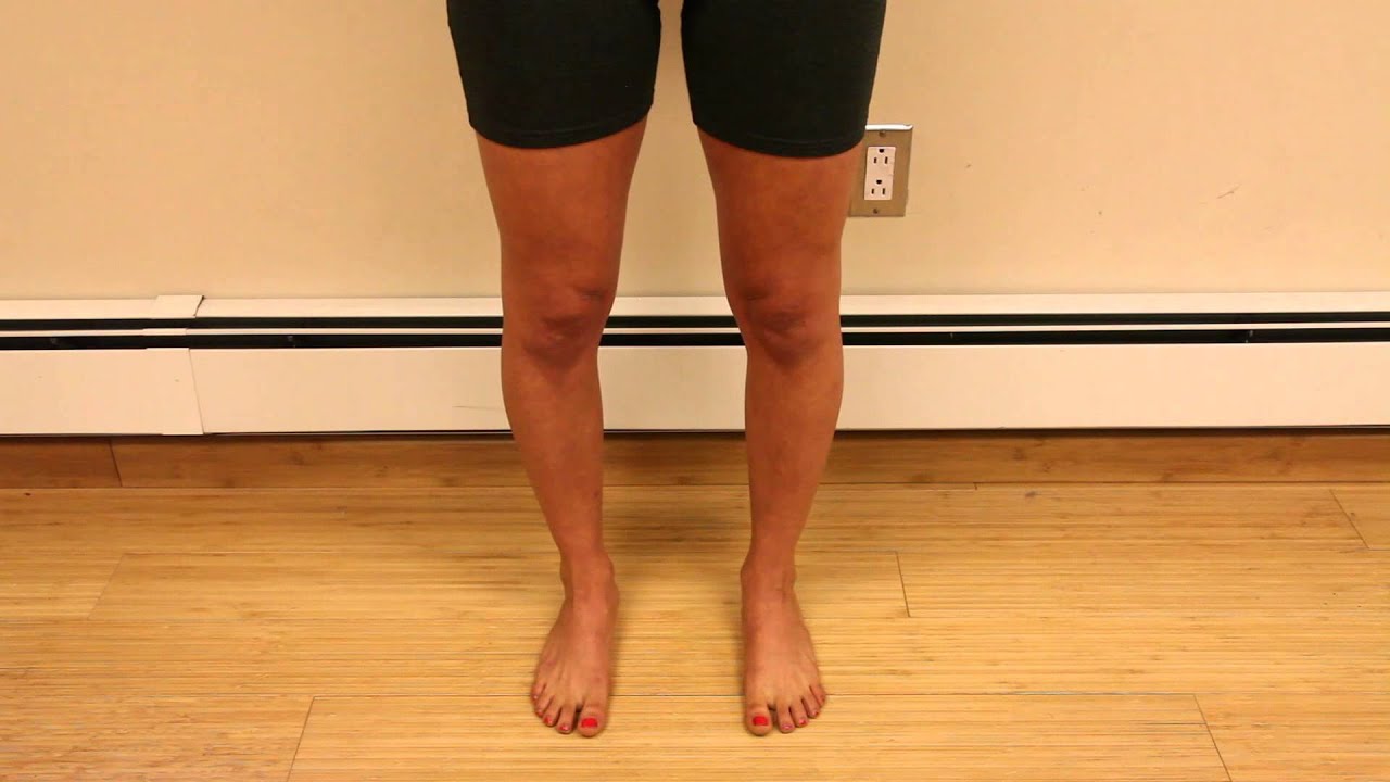 Standing Exam: Talocrural Joint Orientation In Frontal Plane - YouTube