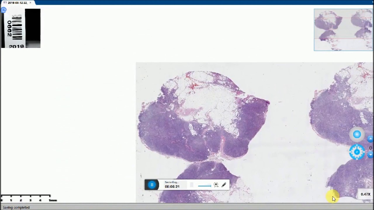Digital Pathology Slide Scanner from Medimeas - YouTube