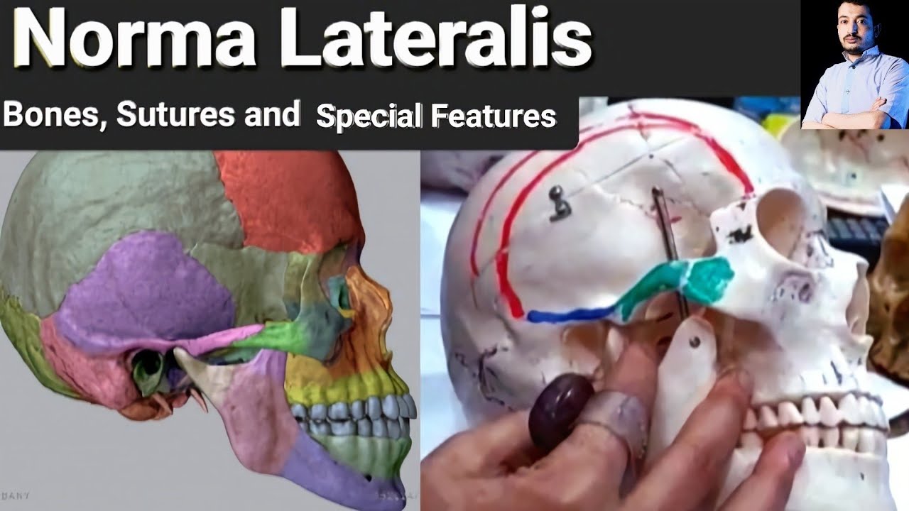 norma lateralis of skull anatomy : Bones, sutures and special features ...