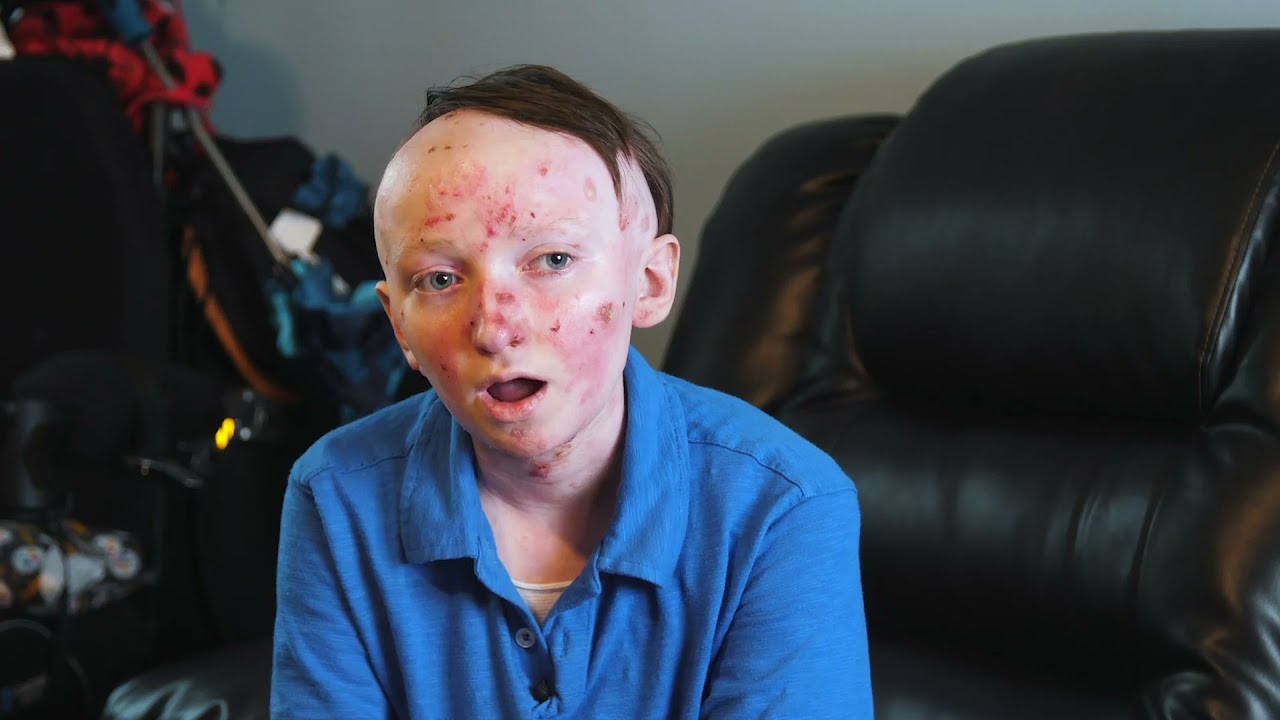 Meet Daisy | The Worst Disease You've Never Heard Of. - YouTube