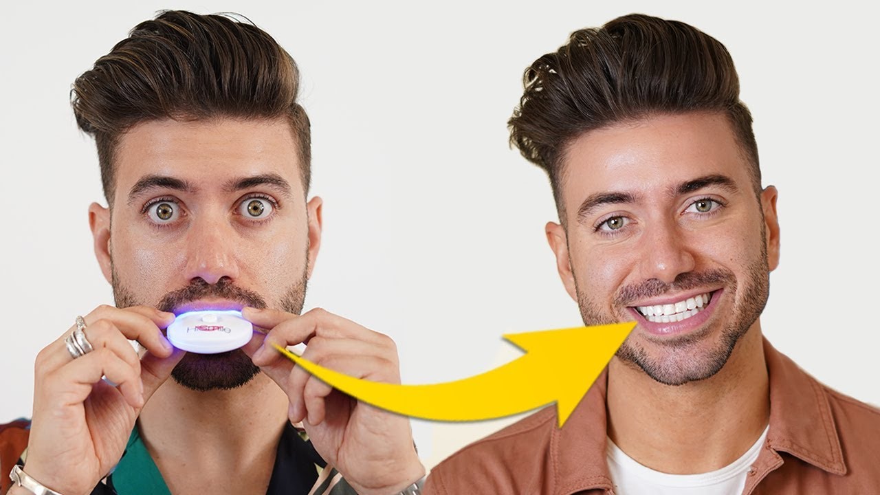 How To Whiten Teeth FAST (100% Works) | Alex Costa - YouTube