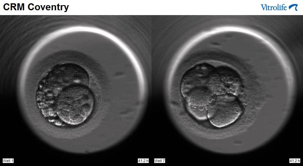 IVF - Embryoscope - 2 Embryos - YouTube