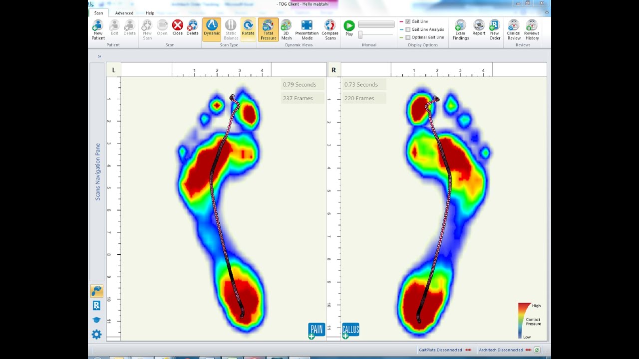 About GaitScan™ Foot Scanning Technology - YouTube