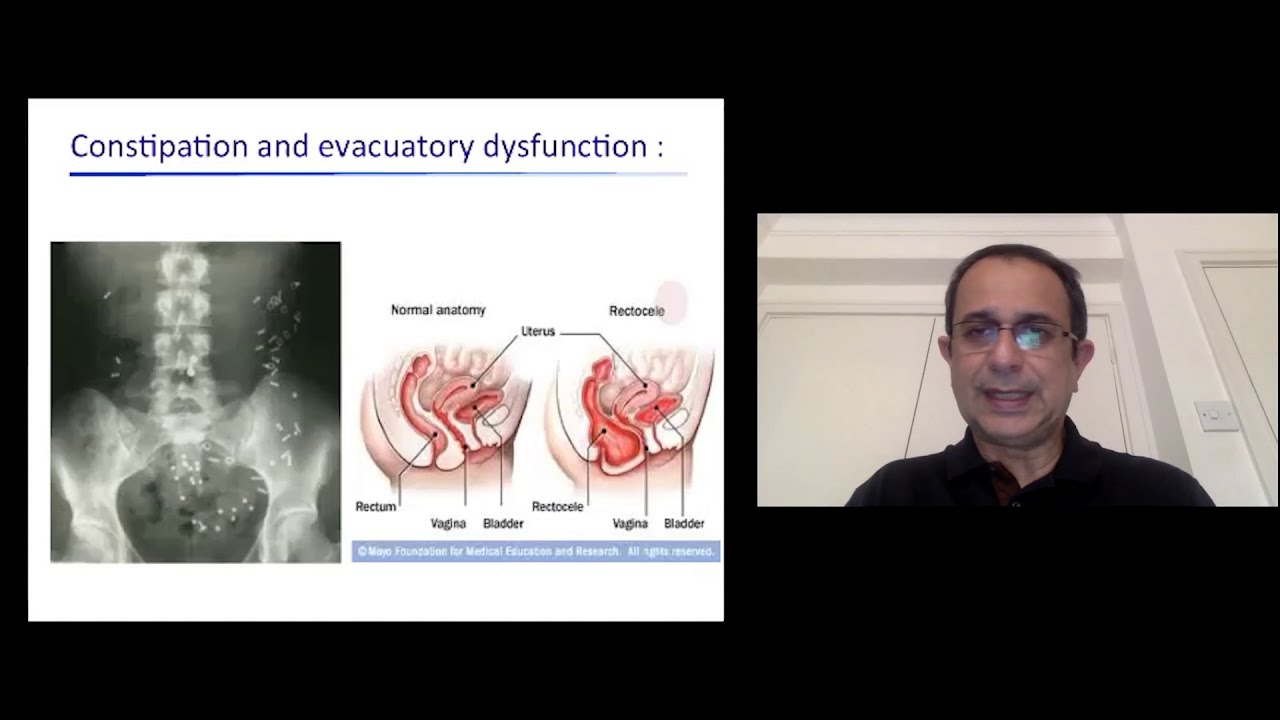 Managing GI Complications - Professor Qasim Aziz | English (EN) - YouTube