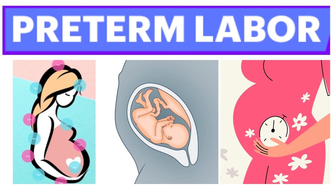 Obstetrics | Preterm Labour 2 - YouTube