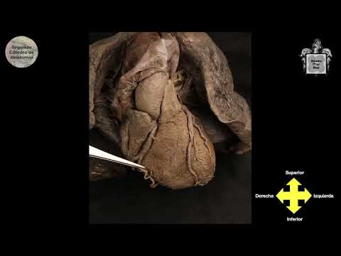 Por Medicoblastos Anatoma Del Corazn Anatomia Histología Del Corazón