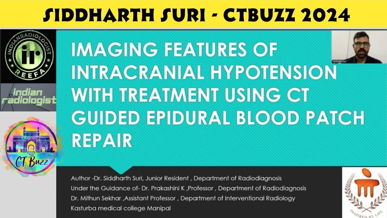 Siddharth Suri | Imaging of Intracranial hypotension and CT guided ...