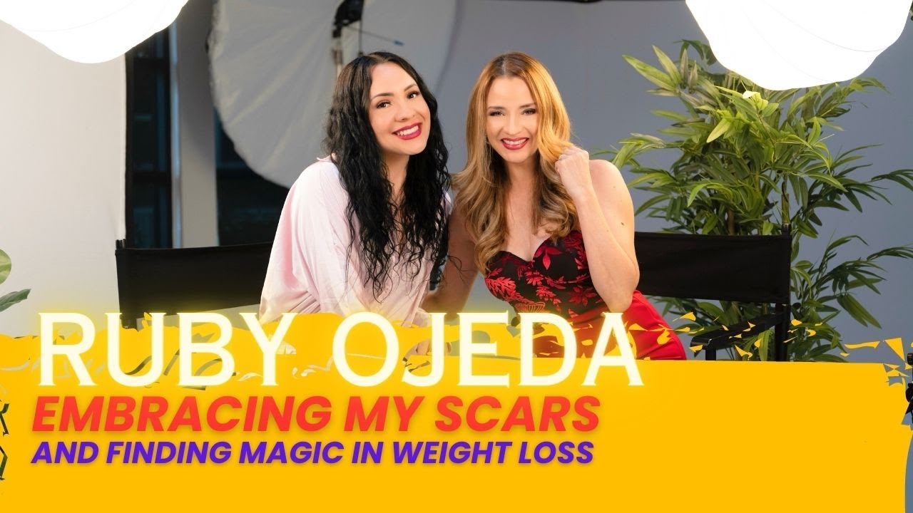 Self-Acceptance: Ruby Ojeda's Journey To Embracing Her Scars and ...