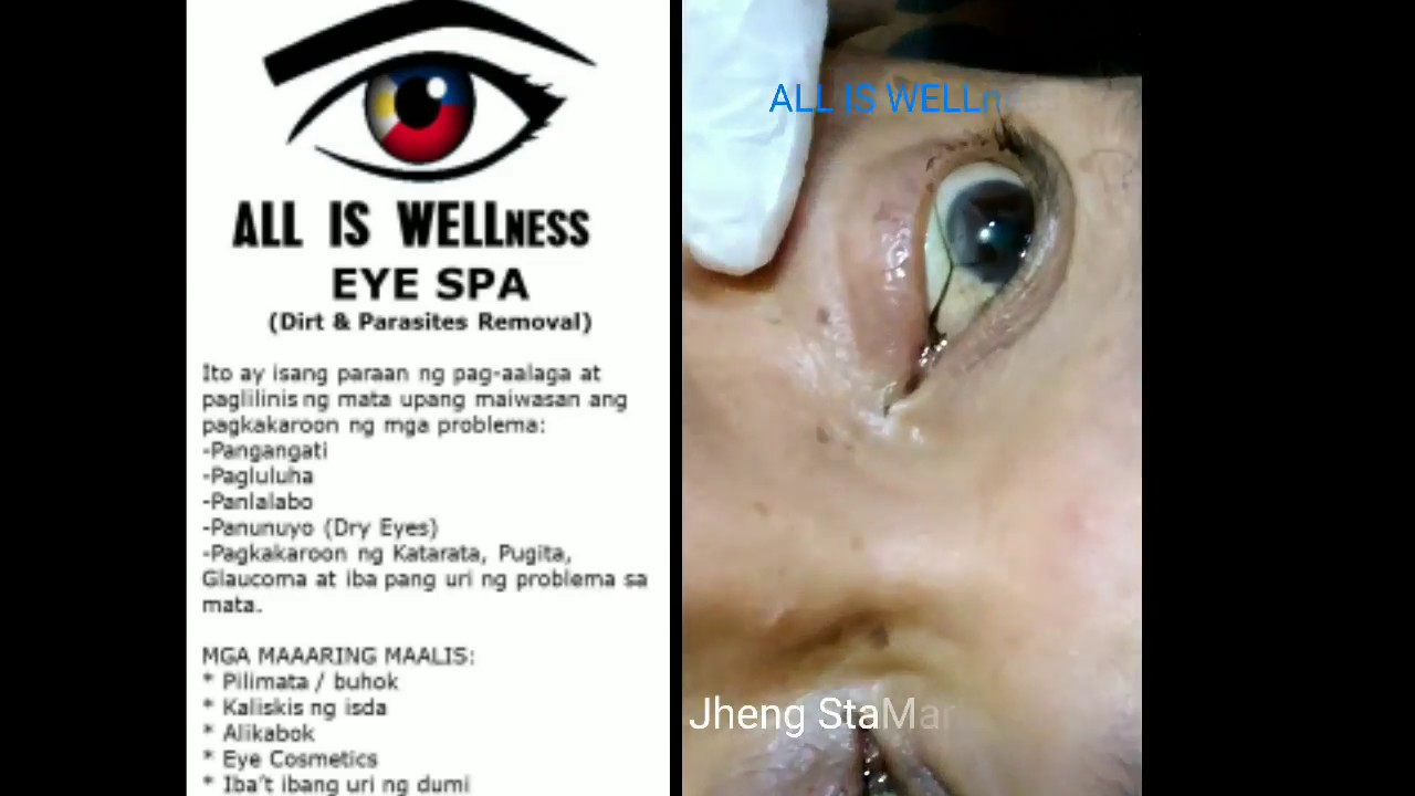 Eye Spa / Eye Detox / Eye Cleaning / Driver - YouTube