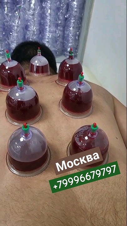 Хиджама массаж фита бочка мануальная терапия ☎️+79996679797 - YouTube