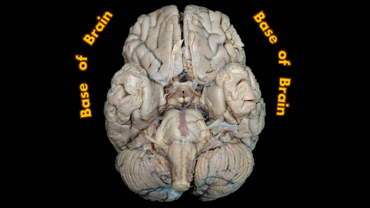 Base of Brain - Specimen Study - YouTube