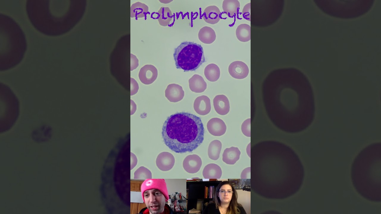 Prolymphocyte