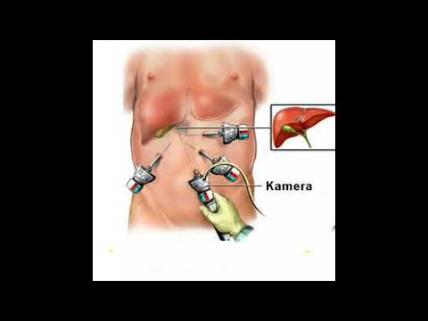 T.e.n. Dr. Fərid Rəfiyev- Bariatriya Şöbəsi