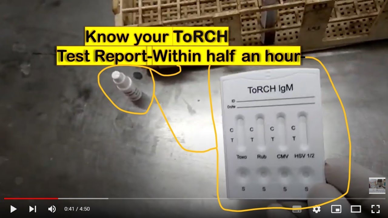 ToRCH IgM Rapid Combo Test Procedure - YouTube