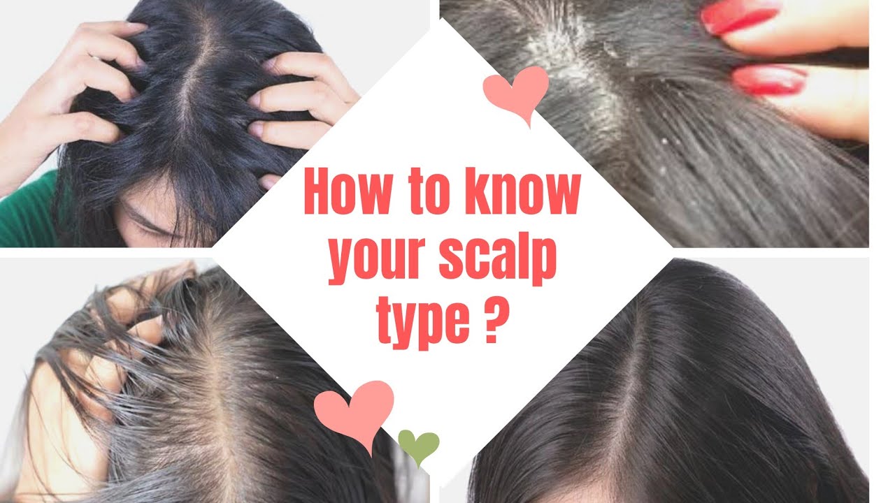 How to know your scalp type? Oil Dry Combination Normal - YouTube
