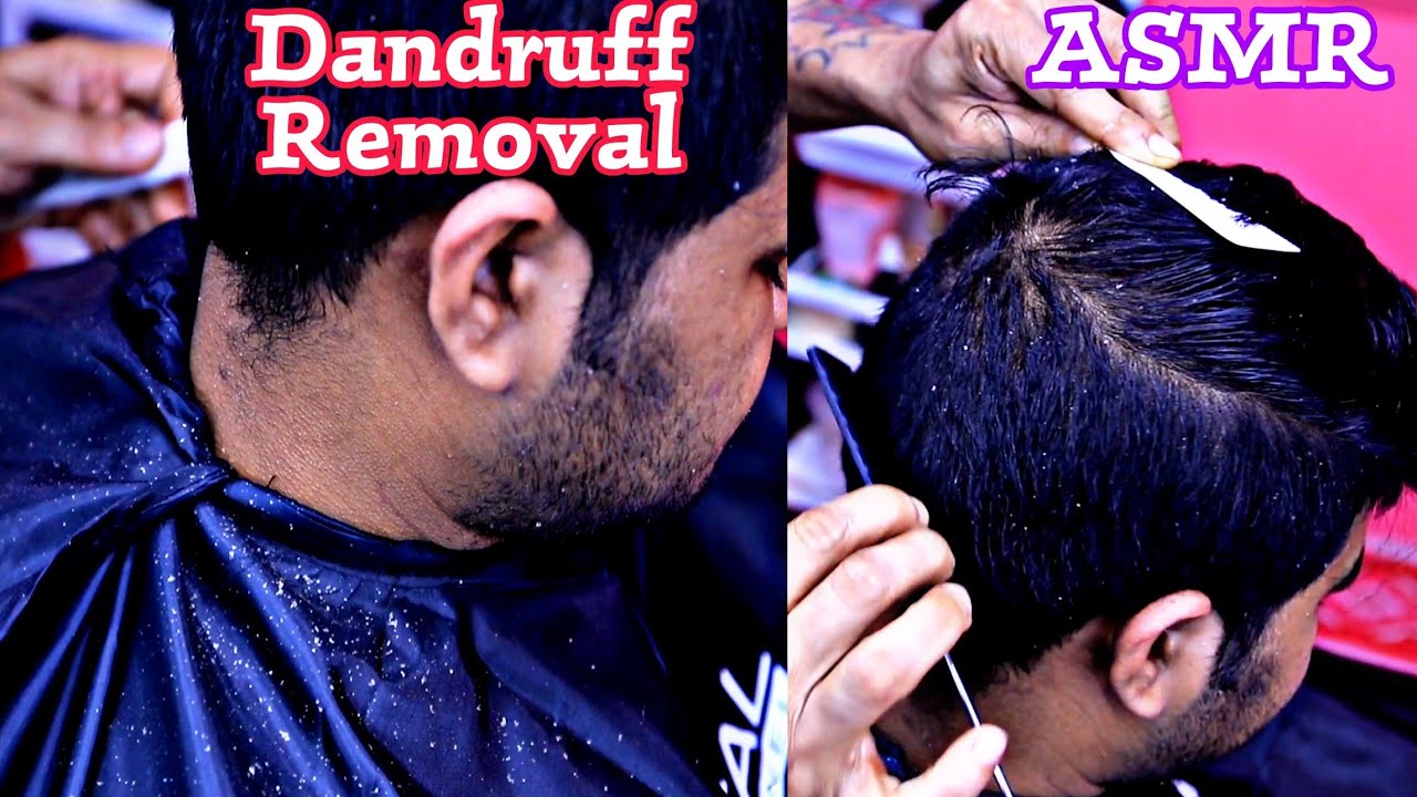 Most satisfying Dandruff removal with ASMR sound | Comb massage with ...