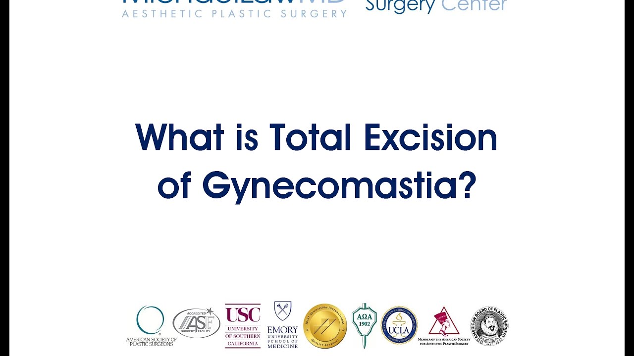What is Total Excision of Gynecomastia - YouTube