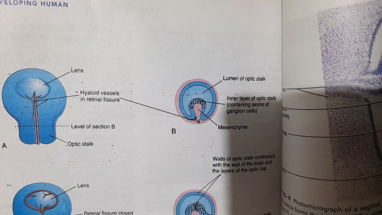 Development of eye | Eye embryology part 1| Easiest explanation - YouTube