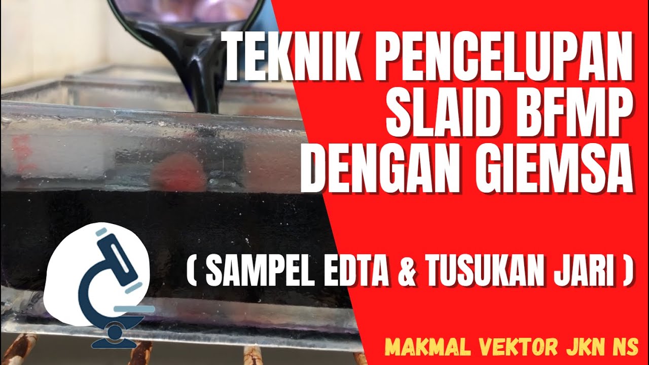 Staining Technique of BFMP Slaid (finger prick & EDTA Blood) Using ...