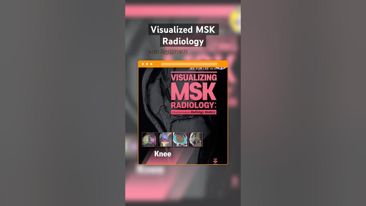 [Book] Visualizing MSK Radiology: KNEE — A New Approach to Knee MRI MRI 자신감 키우기 - YouTube