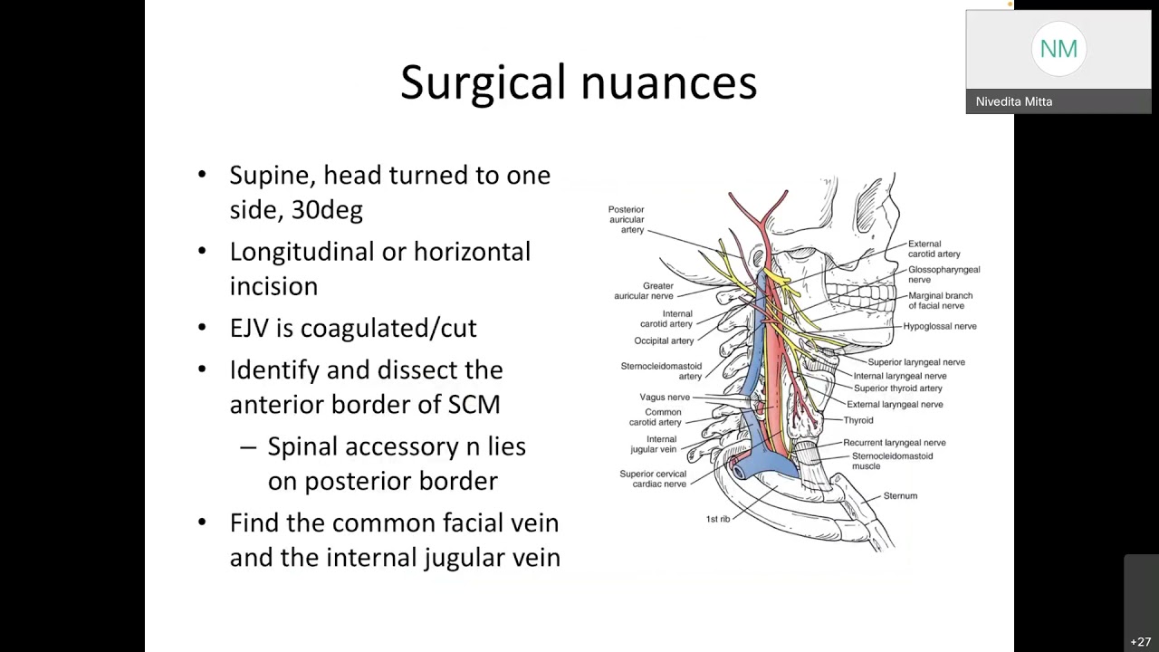 Cerebrovascular Disease CEA + CAS - YouTube