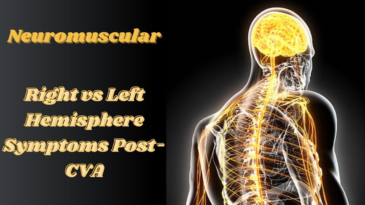Left vs Right Hemispheres Symptoms Post-CVA with NPTE Based PRACTICE ...