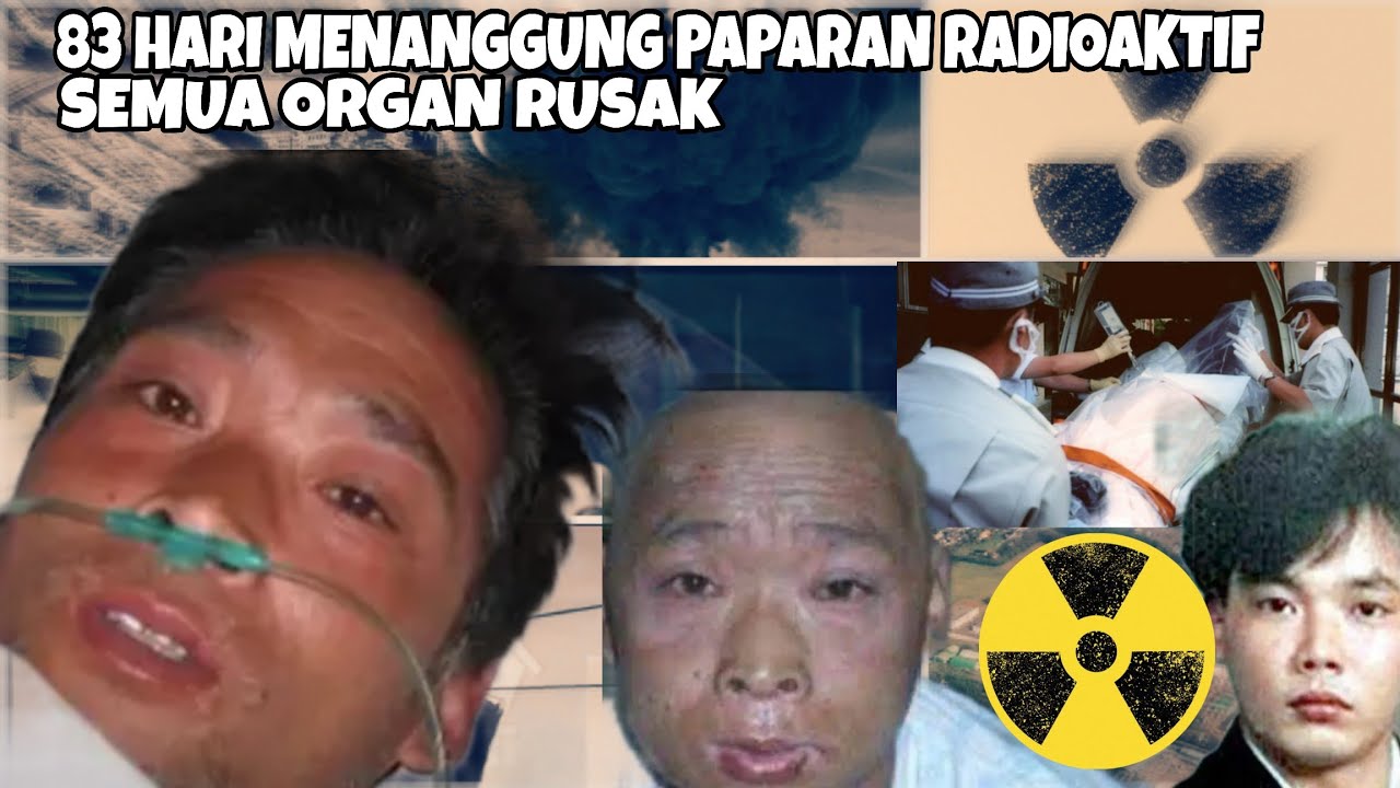 TUBUHNYA PERLAHAN HANCUR, TAK ADALAGI DNA, HINGGA SEMUA ORGAN RUSAK ...