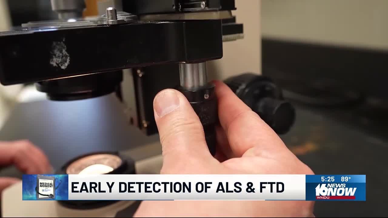 Medical Moment: Early detection of ALS and FTD - YouTube