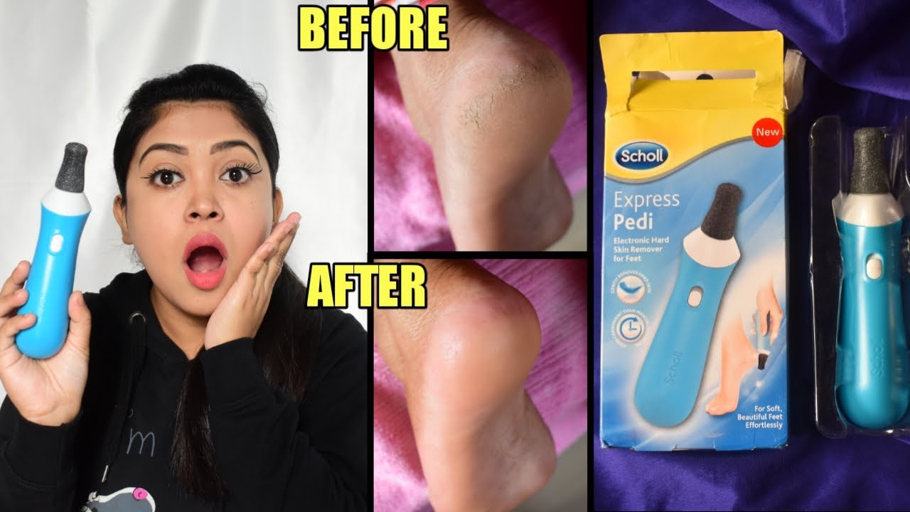 Scholl Express Pedi Review| All about Electronic Foot File| Get Rid of ...