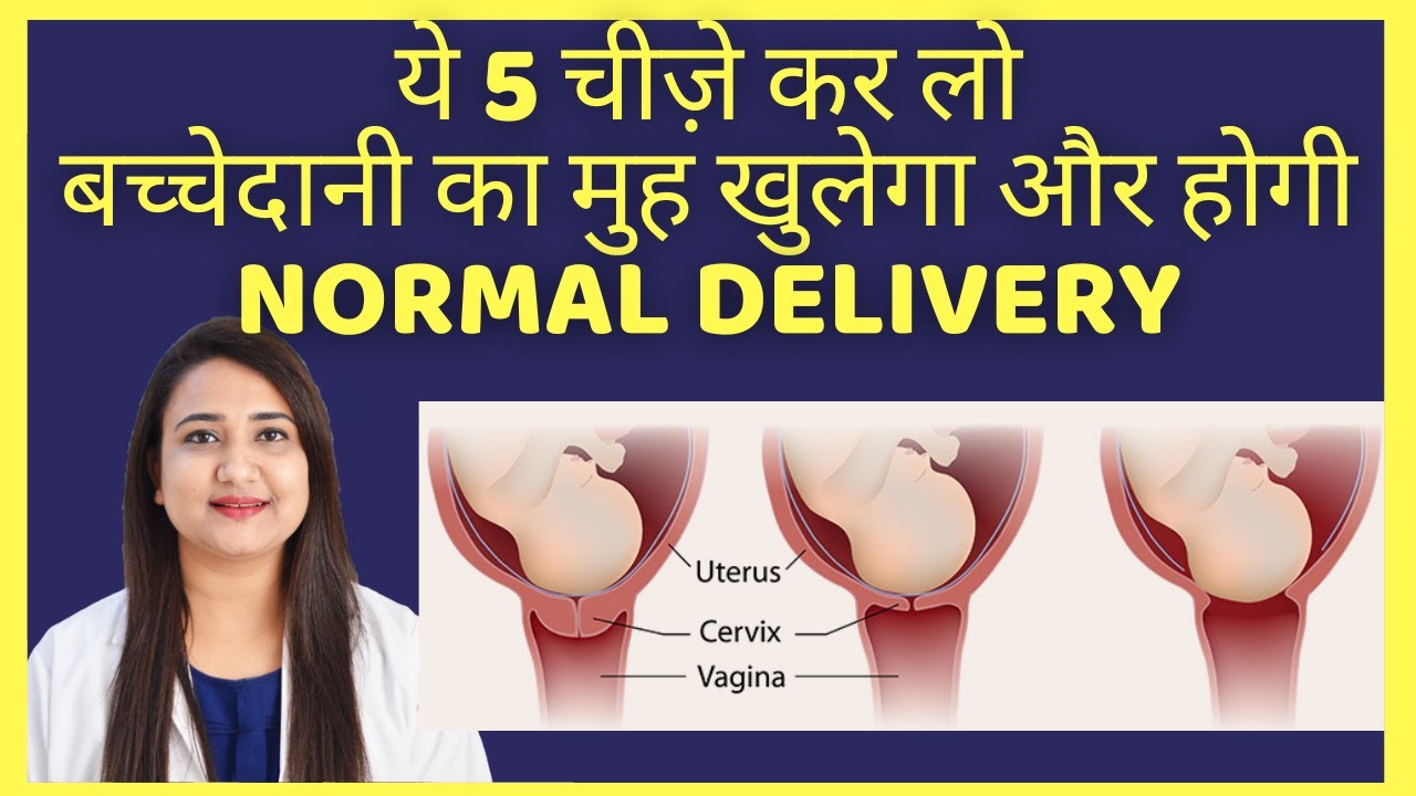 नॉर्मल डिलीवरी के लिए क्या करे ? TOP 5 TIPS FOR NORMAL DELIVERY - YouTube