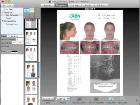 Quick Ceph Studio - Predefined Individual and Comparison Gallery ...