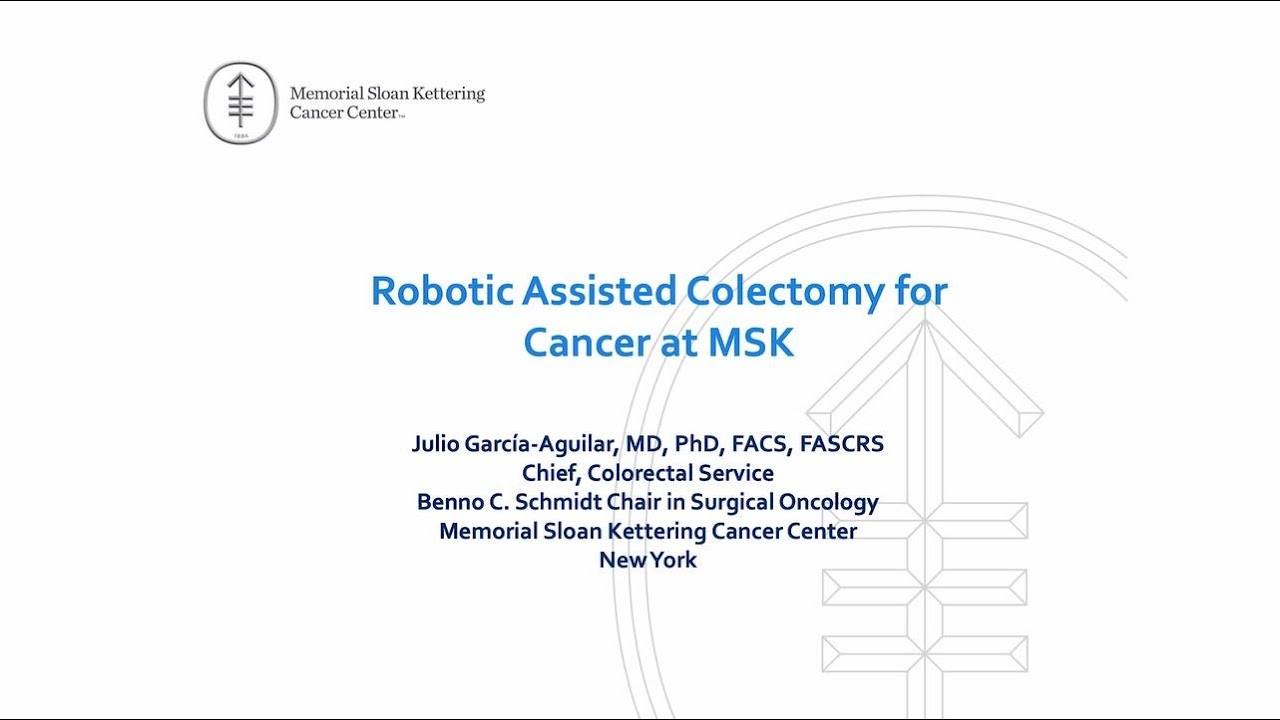 Robotic-assisted Colectomy for Cancer at MSK with Dr. Julio Garcia ...