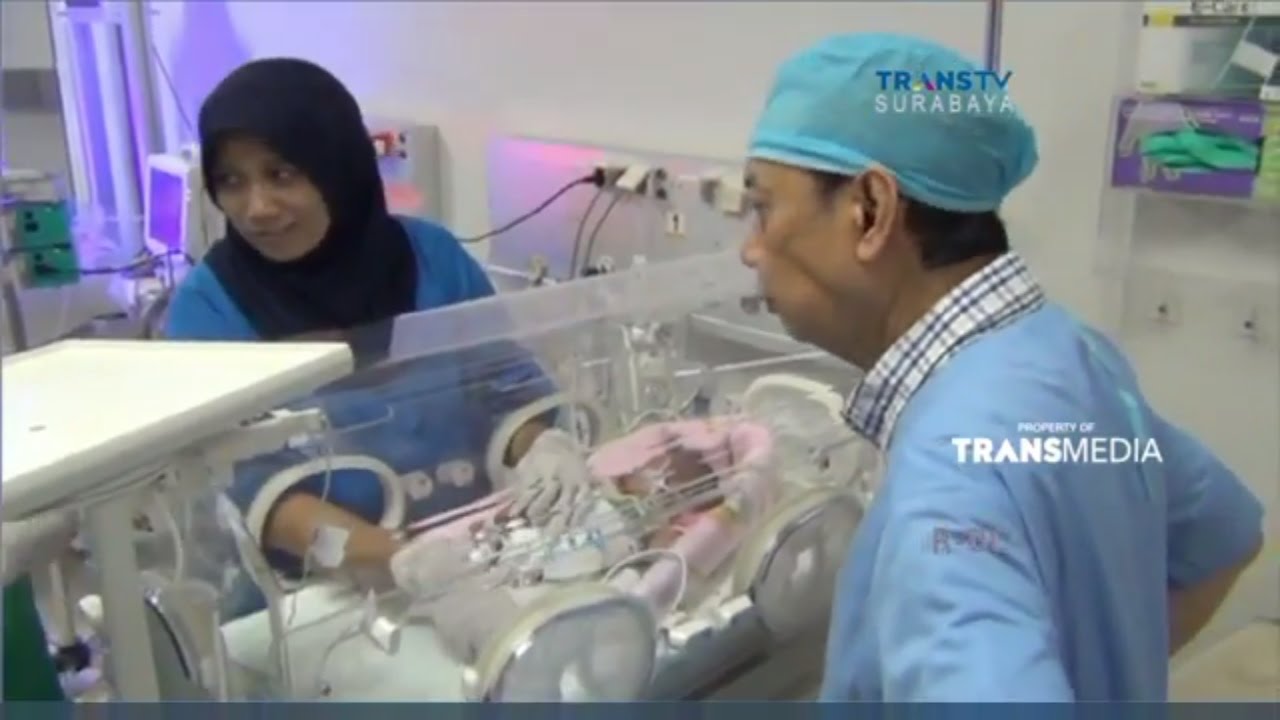 Bayi Kembar Siam Dempet Perut Desta Meninggal - YouTube