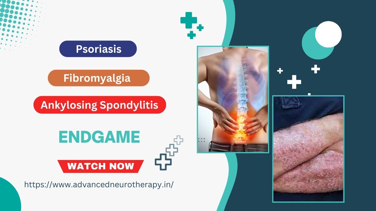 Psoriasis | Fibromyalgia | Ankylosing Spondylitis End Game Treatment By ...
